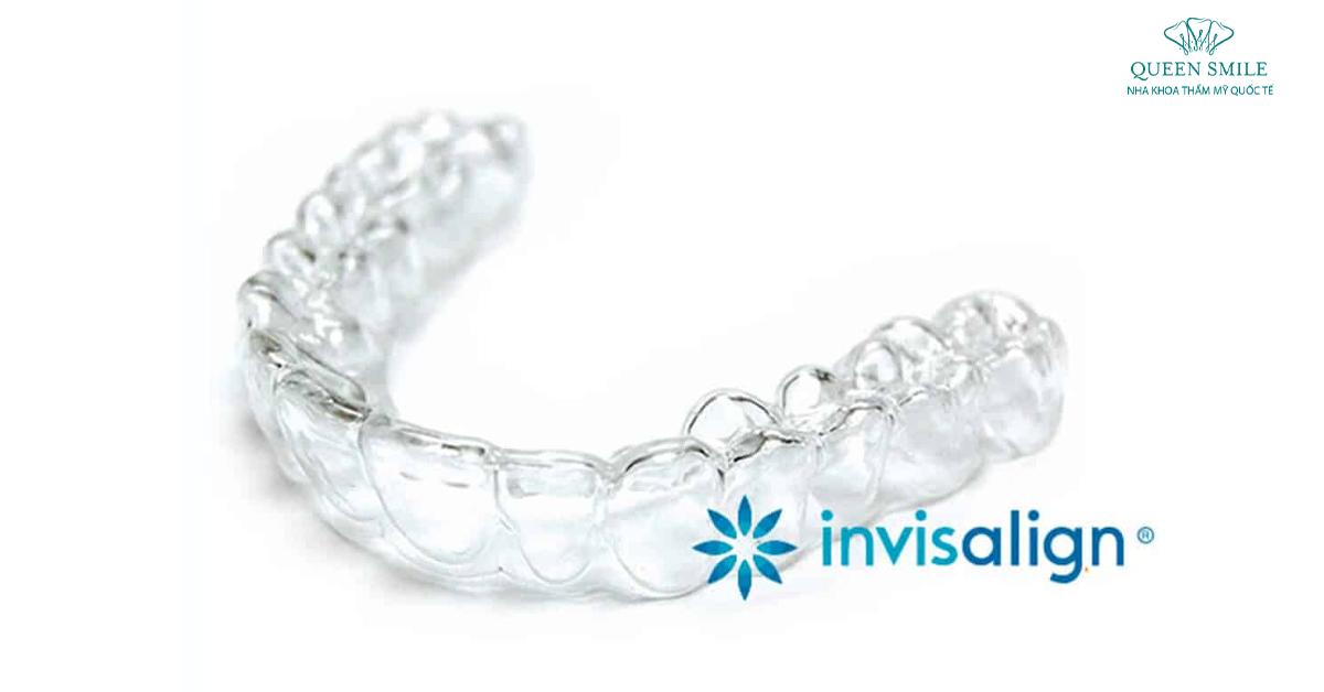 Niềng răng không cố định là gì? - Nha khoa thẩm mỹ Queen Smile